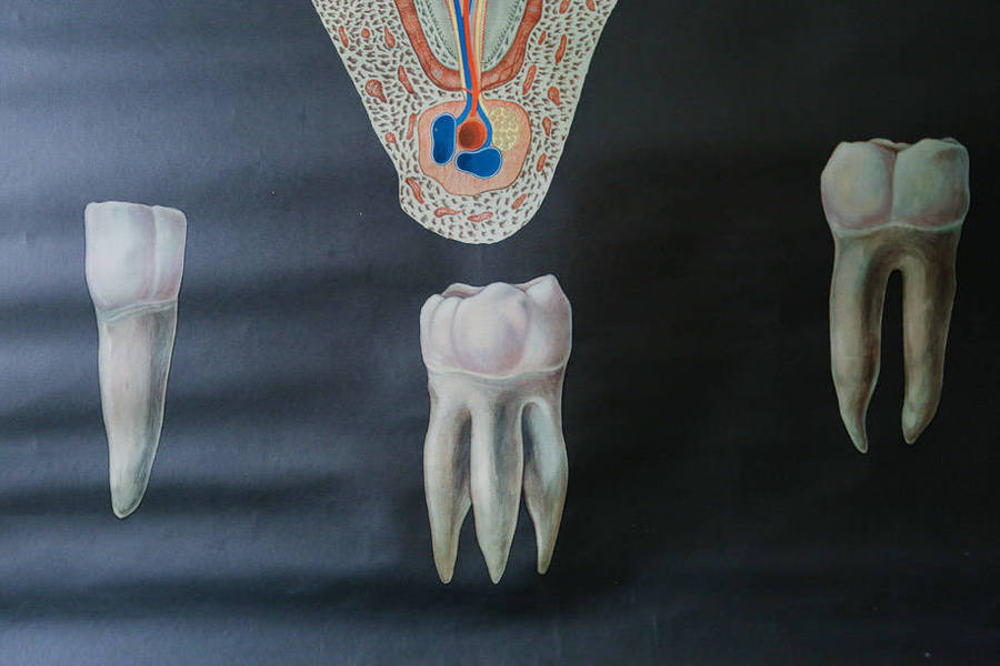 Original Anatomical Vintage German Educational School Wall Chart Teeth ...
